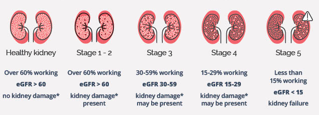 Stages of kidney disease - Kidney Health Australia
